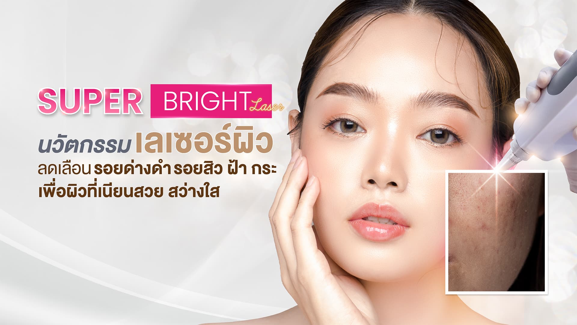 Super Bright Laser ซุปเปอร์ไบร์ทเลเซอร์ นวัตกรรมเลเซอร์ผิว ลดริ้วรอย ...